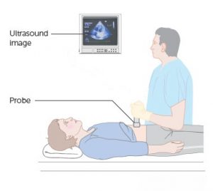 GUS: Gastric Ultrasound Scanner - SONOSIF - by SIFSOF, California