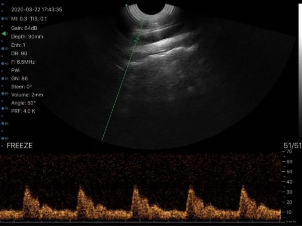 Ecografía Doppler Color Transvaginal Inalámbrica – TRC